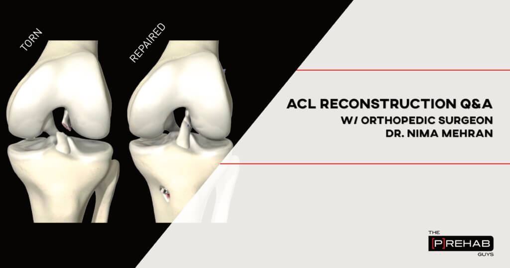 What is the ACL? | 𝙏𝙝𝙚 𝙋𝙧𝙚𝙝𝙖𝙗 𝙂𝙪𝙮𝙨 | Online Physical Therapy
