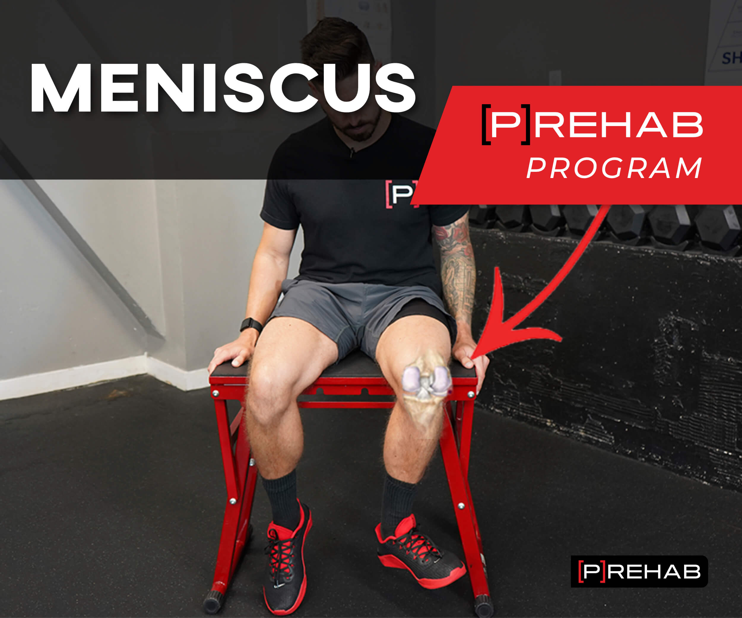 What Is A Meniscus Injury Learn About Meniscus Surgery Rehab рќ ј рќ ґрќ ірќ µрќ рќ ї