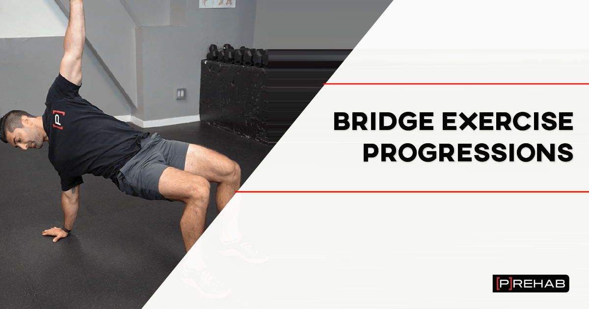 Bridge Exercise Progressions For Rehabilitation: Clinical Pearl – [𝗣]𝗥𝗲𝗵𝗮𝗯