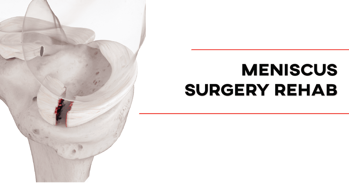 Meniscus Surgery Rehab [P]rehab