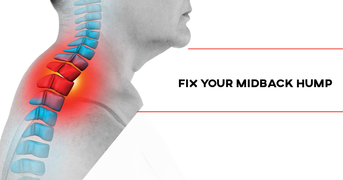 Top 3 Exercises to Prevent Midback Hump - [P]rehab